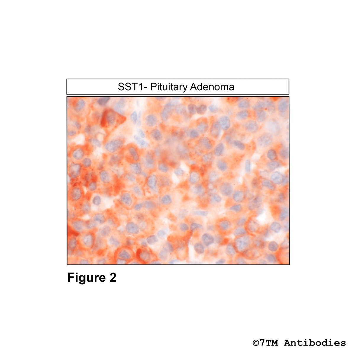 SST1 (IHC-grade), Somatostatin Receptor 1 Antibody | 7TM Antibodies