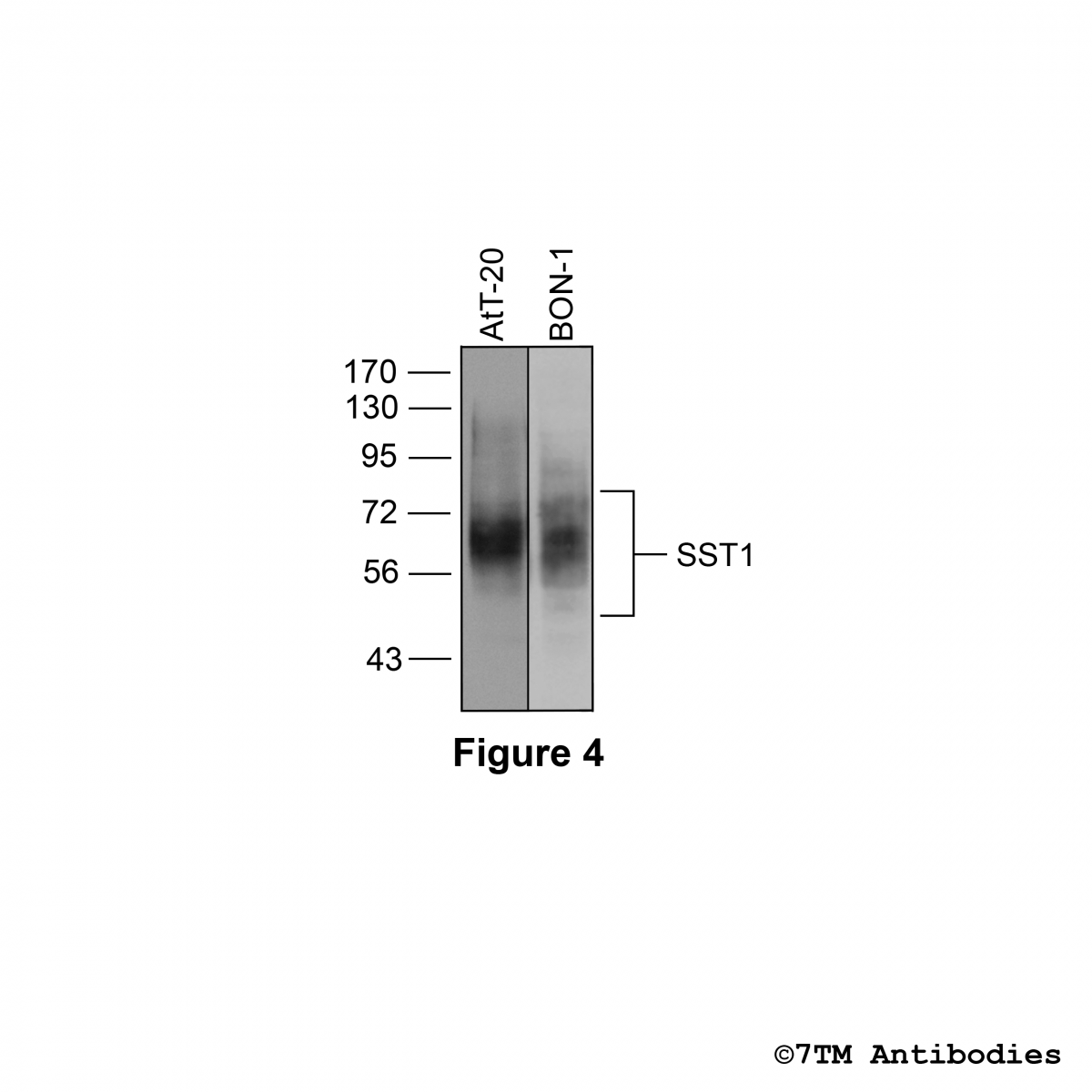 SST1 (IHC-grade), Somatostatin Receptor 1 Antibody | 7TM Antibodies