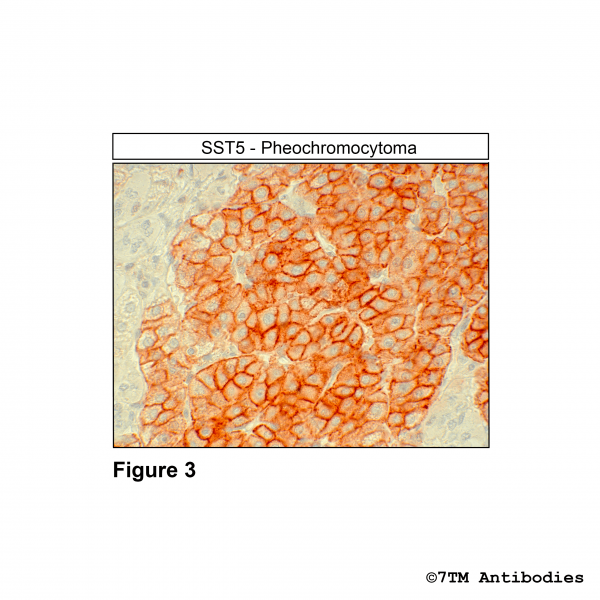 SST5 (IHC-grade), Somatostatin Receptor 5 Antibody | 7TM Antibodies