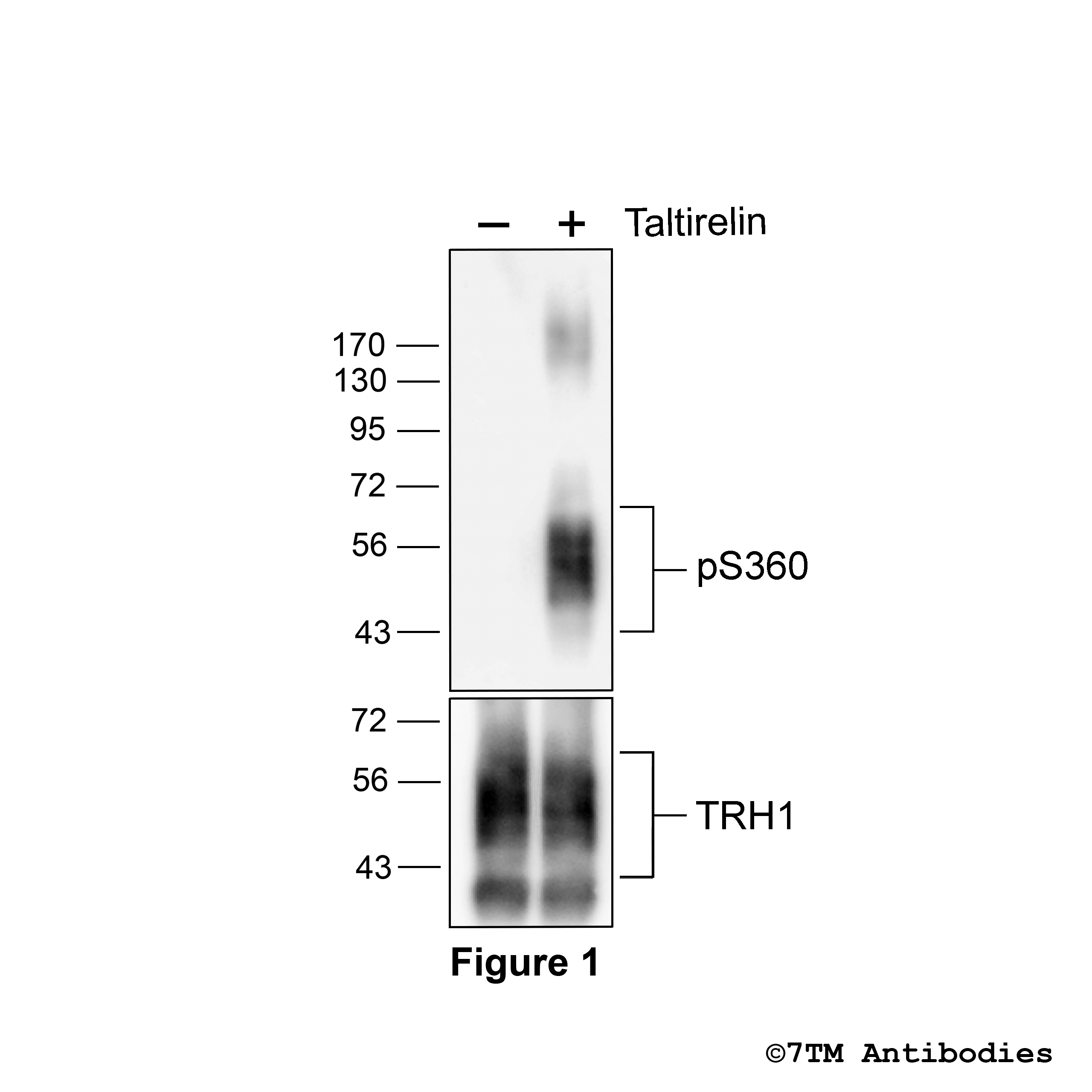 Thyrotropin-Releasing Hormone Receptor Antibodies | 7TM Antibodies®