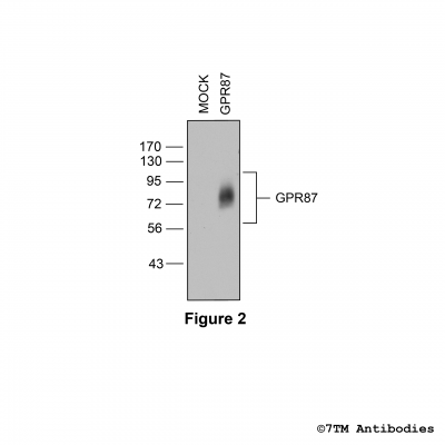 GPR87 (IHC-grade), G Protein-Coupled Receptor 87 Antibody | 7TM Antibodies