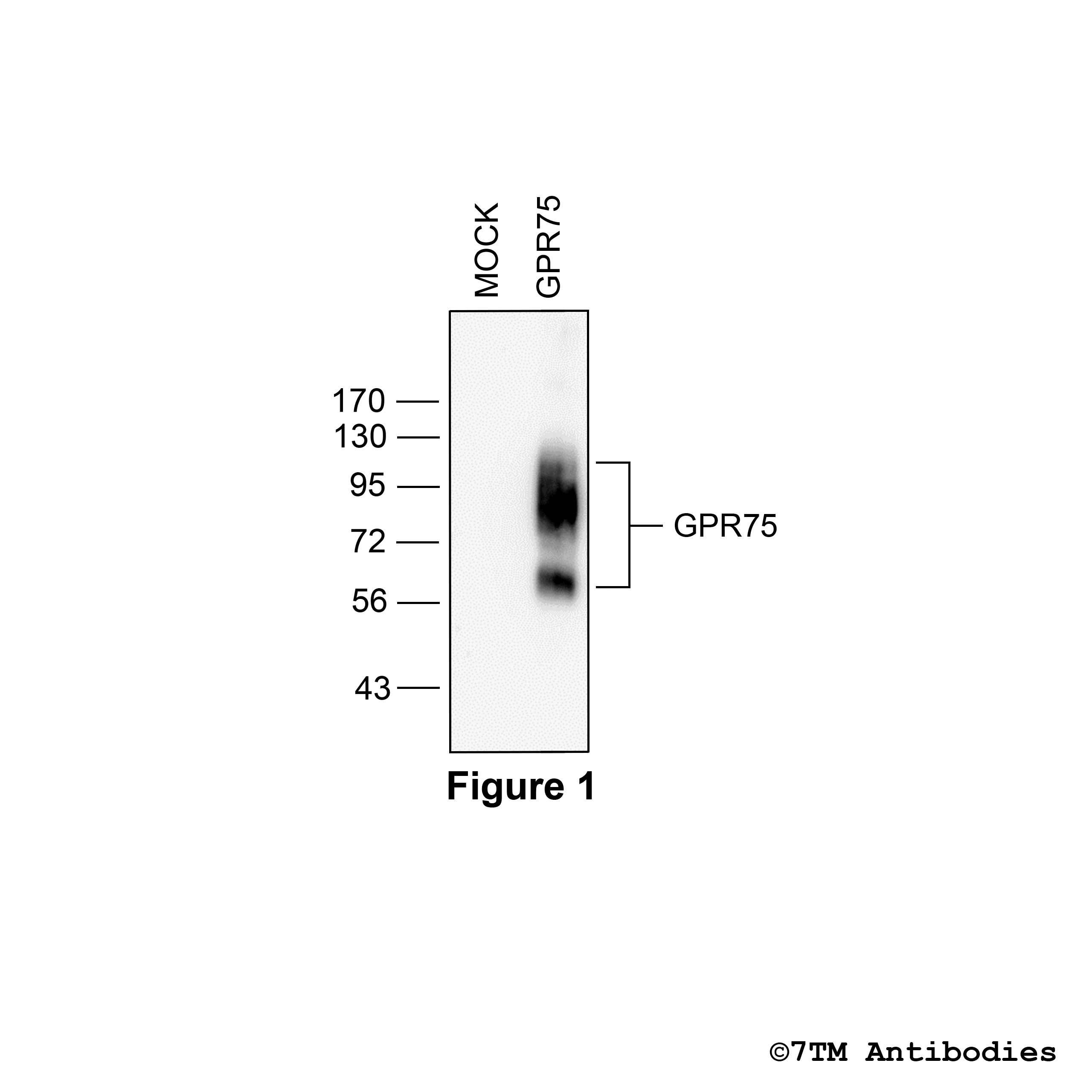GPR75 (non-phospho), G protein-coupled Receptor 75 Antibody | 7TM ...